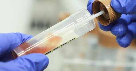 Un mini-rene dalle staminali - Rai News