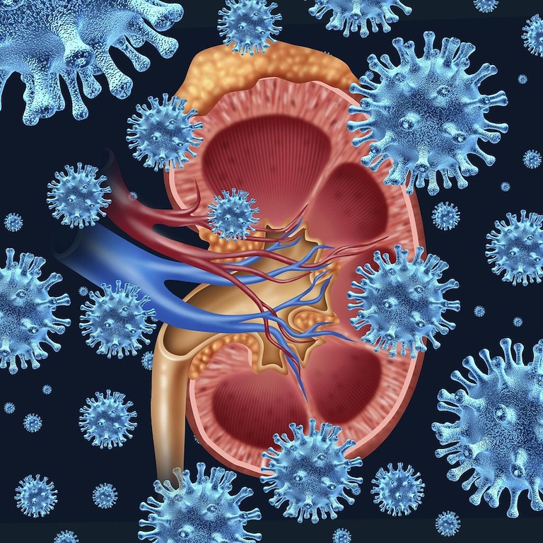 Calcoli renali, sintomi e cure - video - Rai News