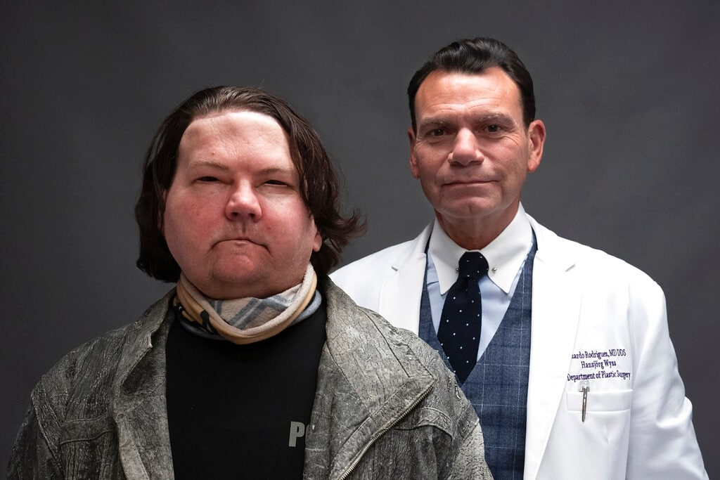 Primo trapianto al mondo simultaneo di volto e mani: la nuova vita di ...